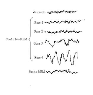 Filosofia CientOOnce: El trastorno de conducta del sueño REM